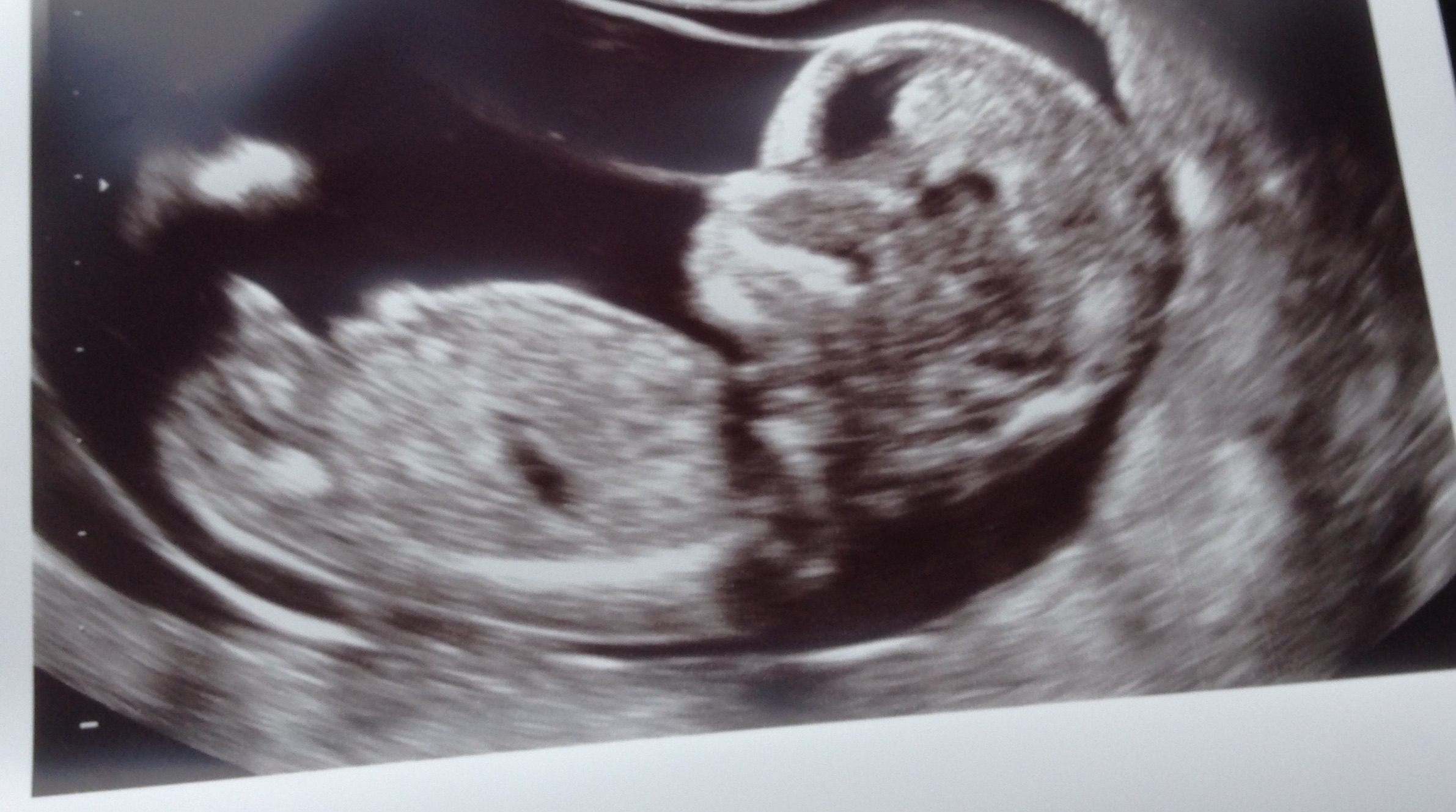 Girl or Boy 12 weeks 4 days Girl or Boy 12 weeks 4 days