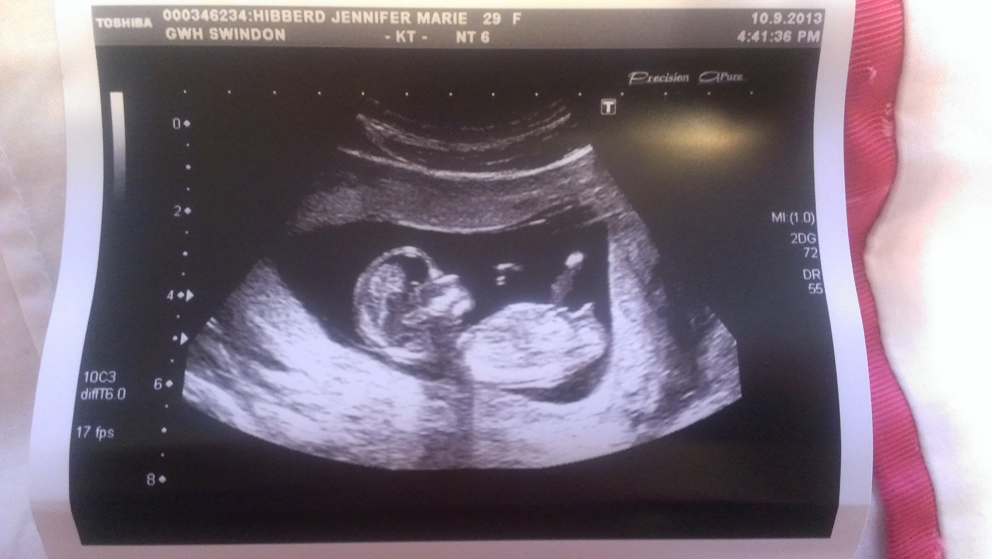 nub theory guesses - 12 weeks